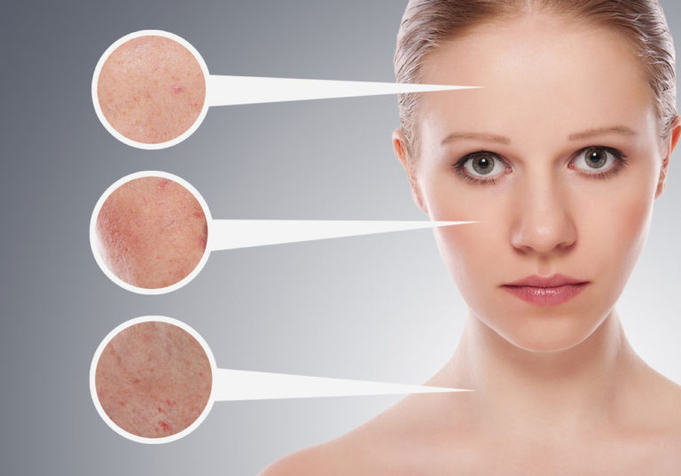 Does Iteracare Health Blower Help In Fighting Skin Problems